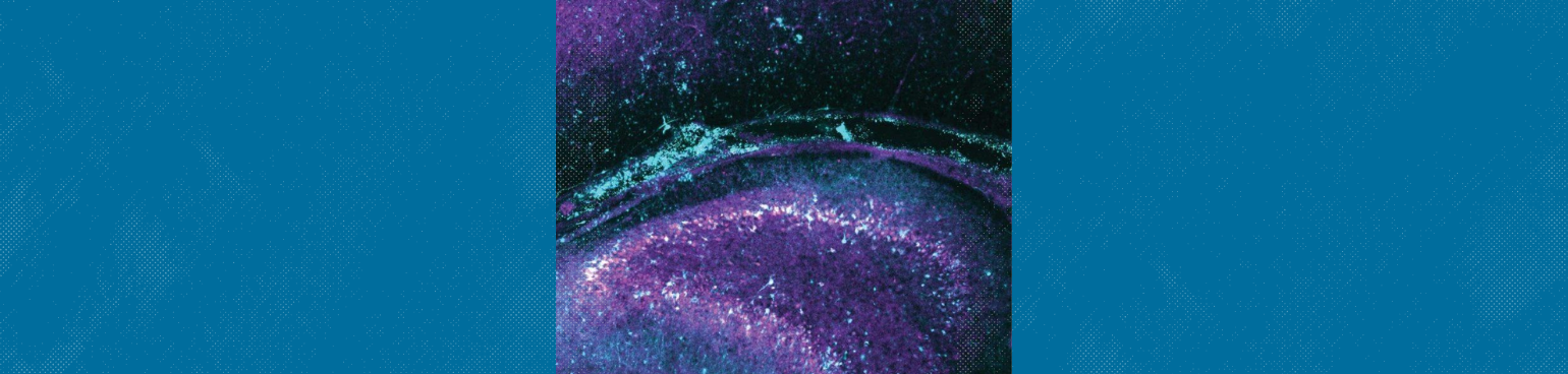 Research from CITRIS PI points to promising epilepsy treatment - CITRIS ...
